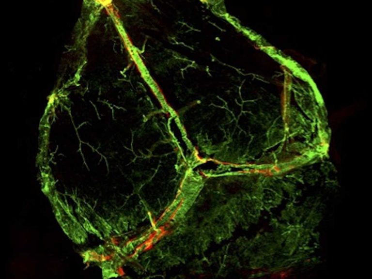 The brain has a direct connection to the lymphatic system - Mapping ...