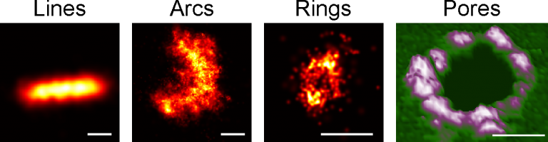 One pore to rule them all: Bax assembles into rings and arcs in ...