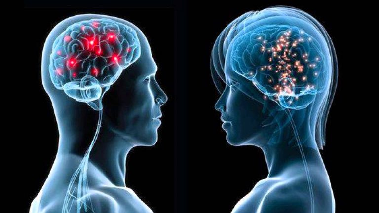 Sexual Differences In The Human Brain Sexual Differences In The Human Brain