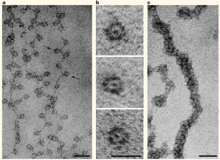 How is chromatin structured? - Mapping Ignorance
