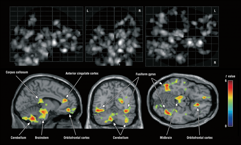 The art of forgetting: microglia eats memories away in mice - Mapping ... The art of forgetting: microglia eats memories away in mice - Mapping ...