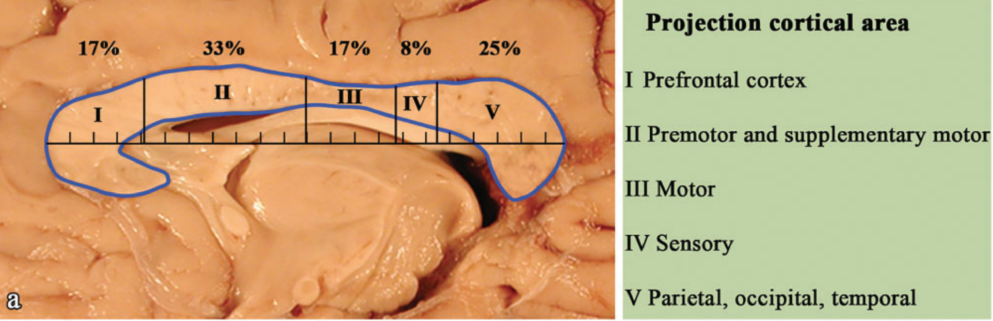 Corpus callosum and autism - Mapping Ignorance